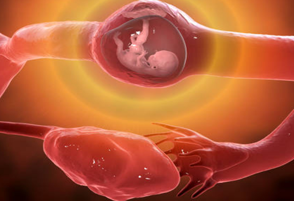 All About Ectopic Pregnancy